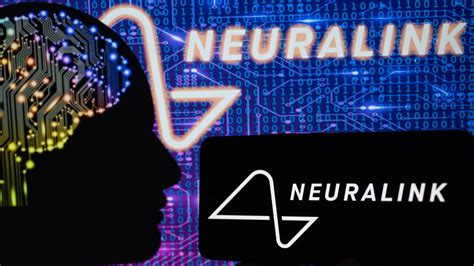 You Wont Believe It — Neuralinks Brain Implant Just Used To Control A Computer Toms Guide