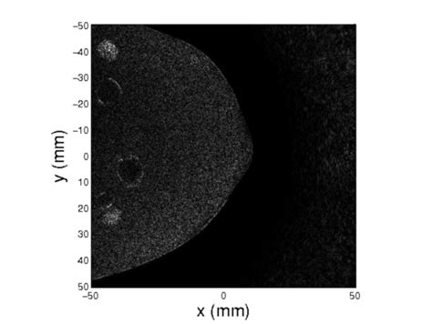 Reconstruction Of The Cirs Phantom The Transducer Array Surrounds The Download Scientific