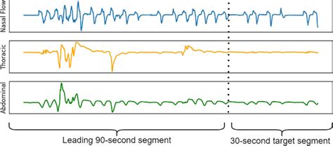 Figure 1 From Sleep Apnea Prediction Using Deep Learning Semantic Scholar