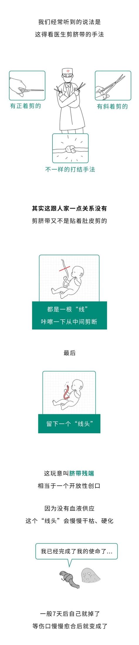 肚臍的形態跟醫生剪臍帶的手法有關？ 壹讀