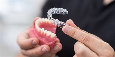 Why Align Technology Stock Is The Sandp 500s Best Performer Barrons