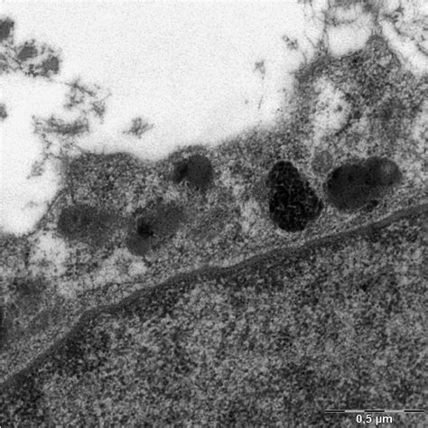 Electron Microscopic Detection Of Gold In A Phagocyte With Numerous