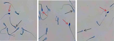 Ab Staining For Sperm Chromatin Maturity And Protamination Ab
