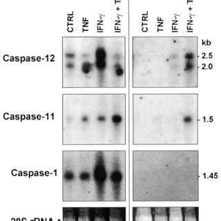 Differential Gene Expression Patterns Of The Mouse Inflammatory Caspase