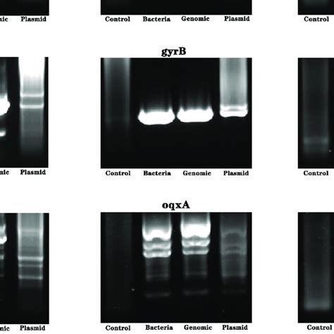 Biochemical Identification Of Pseudomonas Oleovorans Download