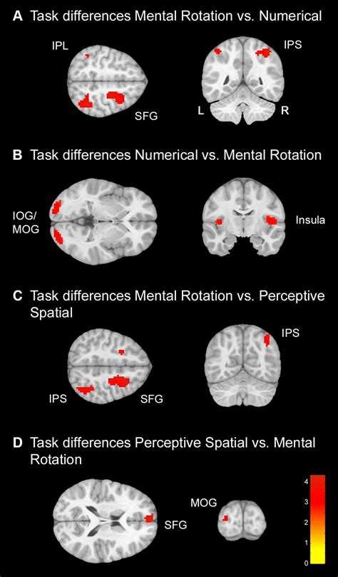 Intraparietal Sulcus Function