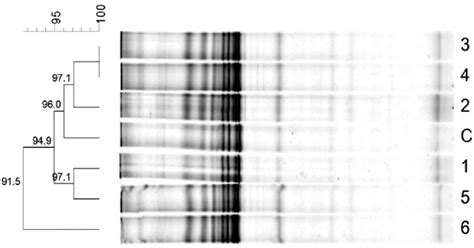 Dendrogram Of Culture Mb Band Pattern Comparison Following Dgge