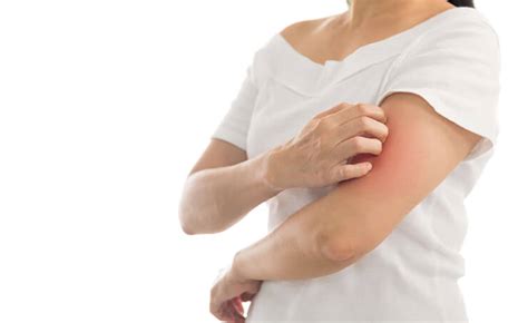 Psoriasi Eritrodermica Esfoliativa Psoriasi Cosa Fare Per Combatterla