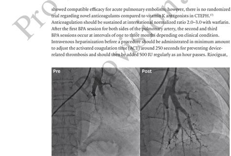 Classification Of Lesion Morphology By Angiogram Various Morphology