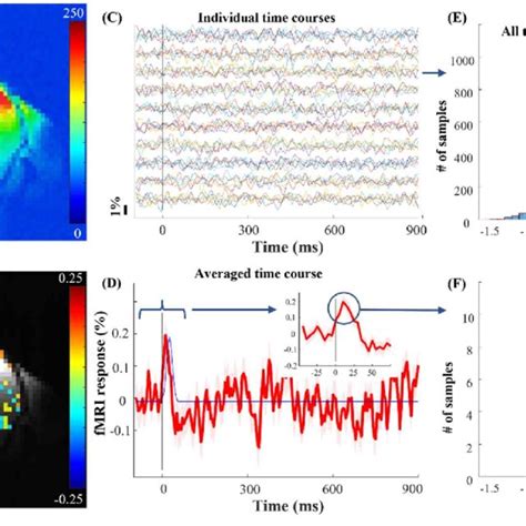 Bold Fmri Of Somatosensory Stimulation In Anesthetized Mice At 152 T