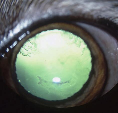 Ophtha Lec 6 Lens And Glaucoma Flashcards Quizlet