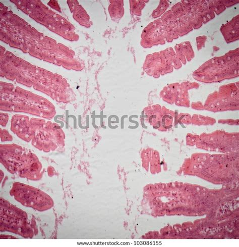 29 Imágenes De Intestinum Tenue Imágenes Fotos Y Vectores De Stock Shutterstock