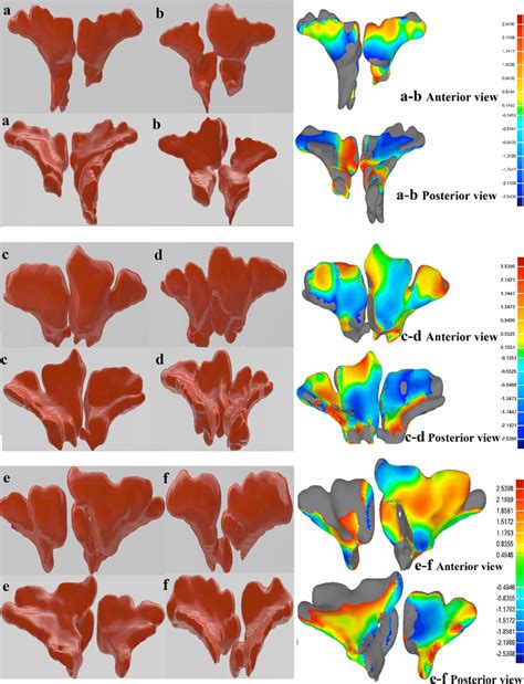 three examples of registration and superimposition of two 3d models