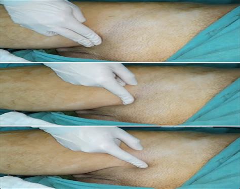 Journal Of The Anatomical Society Of India