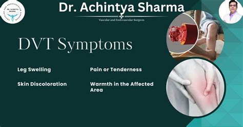 Recognizing Dvt Symptoms Signs Of Deep Vein Thrombosis