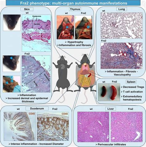 Op0206 Fra2 Is Playing A Key Role In The Control Of Treg Development