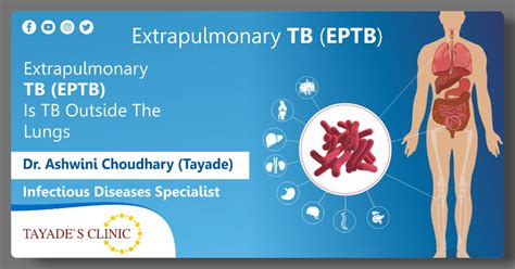 Extrapulmonary Tuberculosis Eptb Dr Ashwini Tayade