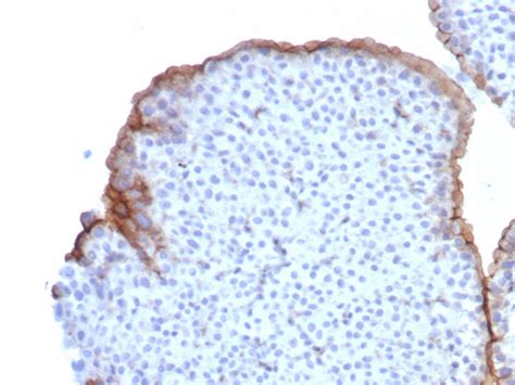 Uroplakin 3b Upk3b Marker Of Mesothelial And Umbrella Cells Recombinant Monoclonal Antibody