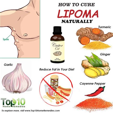 How To Treat Lipoma Naturally Top 10 Home Remedies