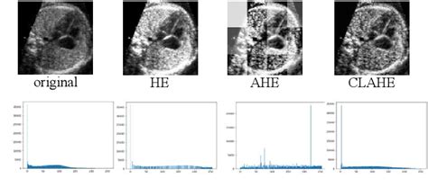 Figure 2 From Histogram Equalization Methodologies Comparison For Deep