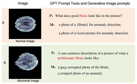 Biomolecules Free Full Text Medicalclip Anomaly Detection Domain