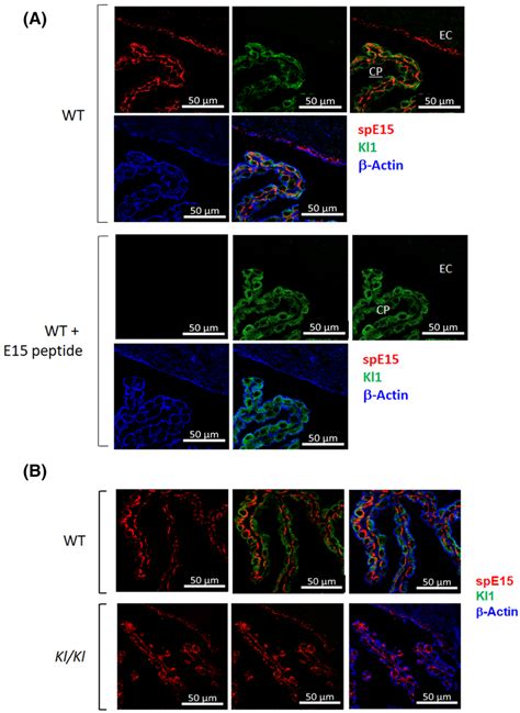 Immunohistochemistry Of Mouse Brain Choroid‐plexus Mouse Brain Download Scientific Diagram