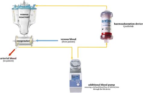 Integration Of The Haemoadsorption Device Into The Cardiopulmonary