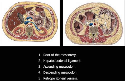 Root Of Mesentery Anatomic And Pathologic Review Semantic Scholar