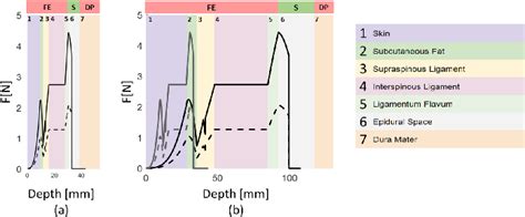 Figure 3 From Design And Validation Of A Bimanual Haptic Epidural Needle Insertion Simulator