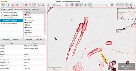Annotating In Qupath — Cellpose Training Gui Documentation