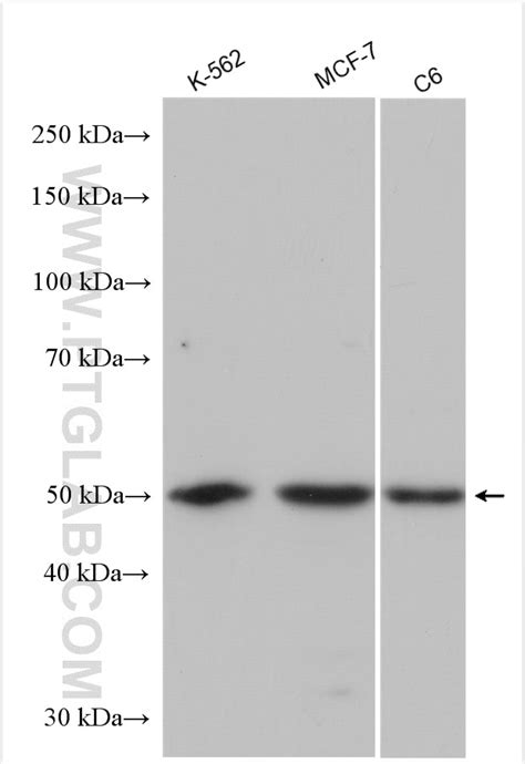 Ppp2r2a Antibody 16569 1 Ap Proteintech