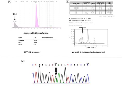 Confirmation Of The Hemoglobin Variant Hemoglobin Analysis Determined Download Scientific