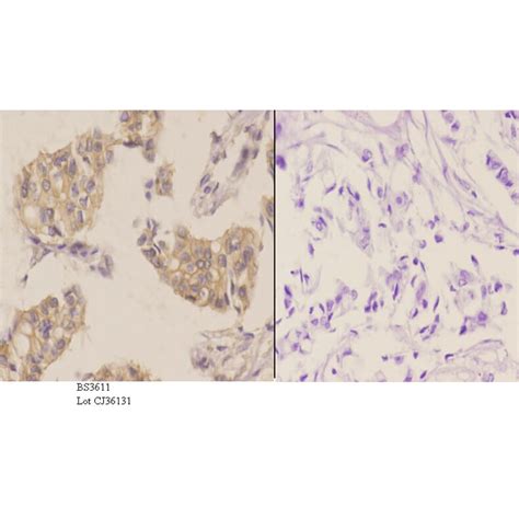 Anti Mtor S2442 Antibody A27028