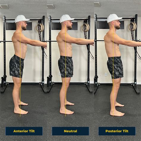 How To Fix Posture Anterior Pelvic Tilt Posterior Pelvic Tilt