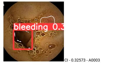 Github Stonerrb Misahub Classification And Detection Of Bleeding And Non Bleeding Edges On