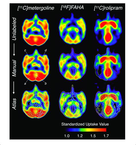 Comparison Of The Manual And Atlas Based Segmentation Performed On