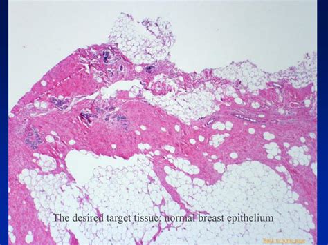Ppt Requirements For Good Tissue Microarray Tma Results Powerpoint Presentation Id 4513355
