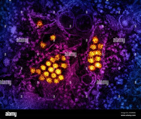Transmission Electron Micrograph Of Dengue Virus Particles Gold Dengue Virus Particles 016867