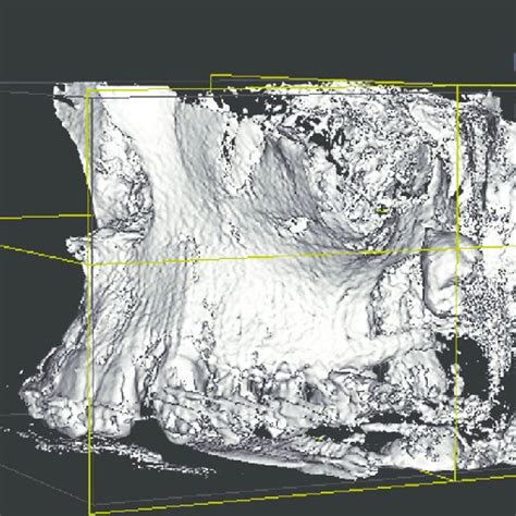 The Three Dimensional Cone Beam Computed Tomography Reconstruction Download Scientific Diagram