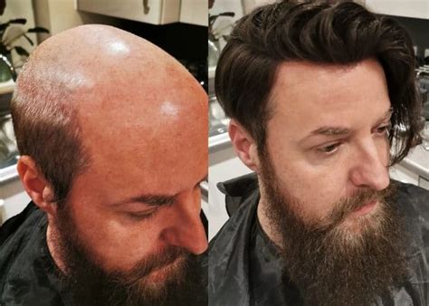 20 Trendiest Toupee Haircuts To Try In 2025