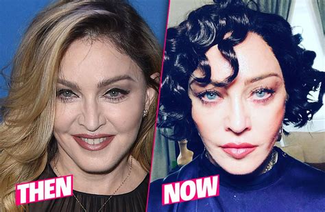 Madonnas Shocking Plastic Surgery Makeover Exposed By Top Docs
