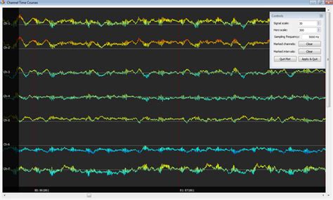 Simultaneous Eeg Fmri Fmri Artifact Detection And Removal