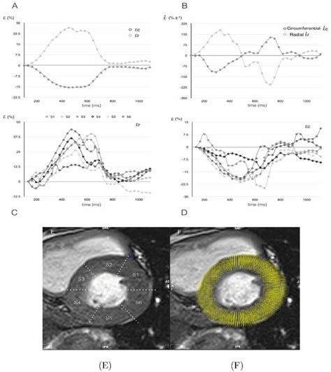 A Global Radial Strain εr And Circumferential Strain εc Obtained Download Scientific