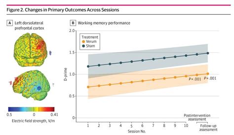 Rct Prefrontal Anodal Transcranial Direct Current Stimulation Induced