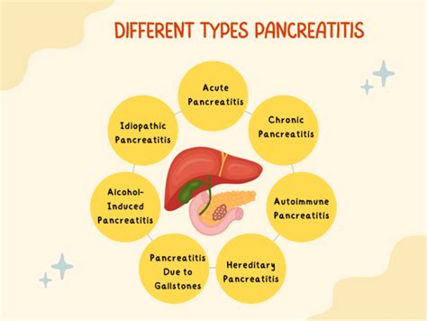 Understanding Pancreatitis Exploring Its Different Types Gastro Doc