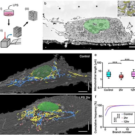 Electron Microscopic 3d Reconstructions Showing Mitochondrial