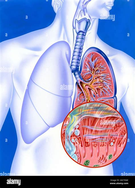 Lower Respiratory Tract Infection Artwork Of A Lung In A Human Figure