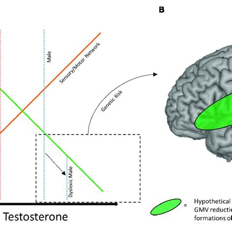 Framework For Sex Differences In Dyslexia Brain Anatomy A