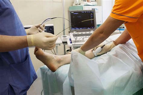 Radiofrequency Ablation For Varicose Veins Treatment Options