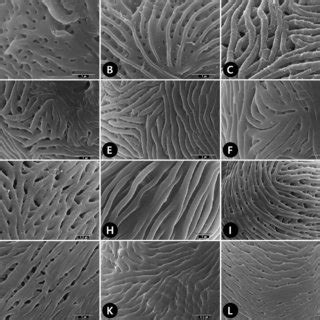 LM Micrographs Of Pollen Grains Of Spiraeeae AH The Outline Download Scientific Diagram